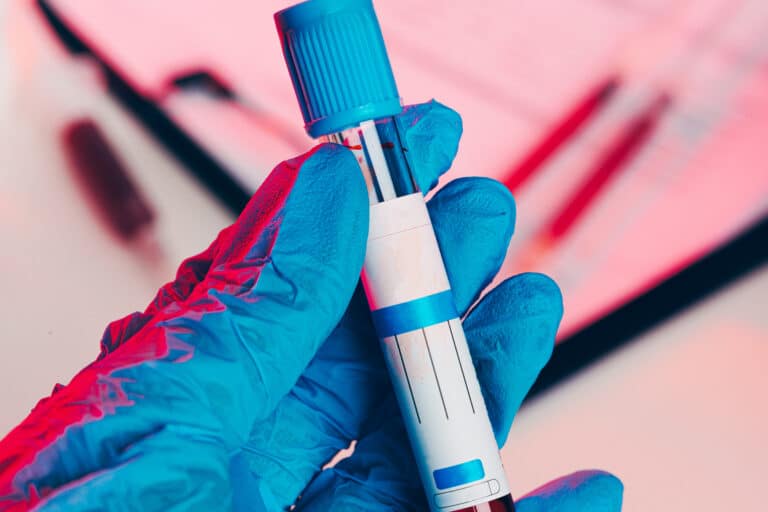 What is Mobile Phlebotomy? - Advanced Mobile Phlebotomy Professionals